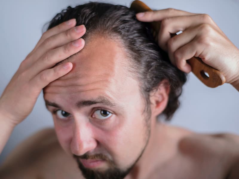 Is Finasteride Safe For Long Term Use?