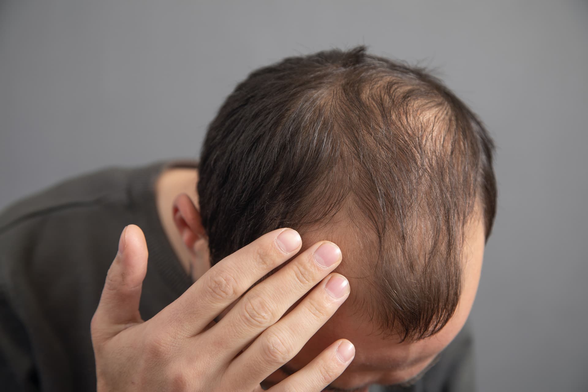 Exploring the link between NAD+ & Hair Regrowth?