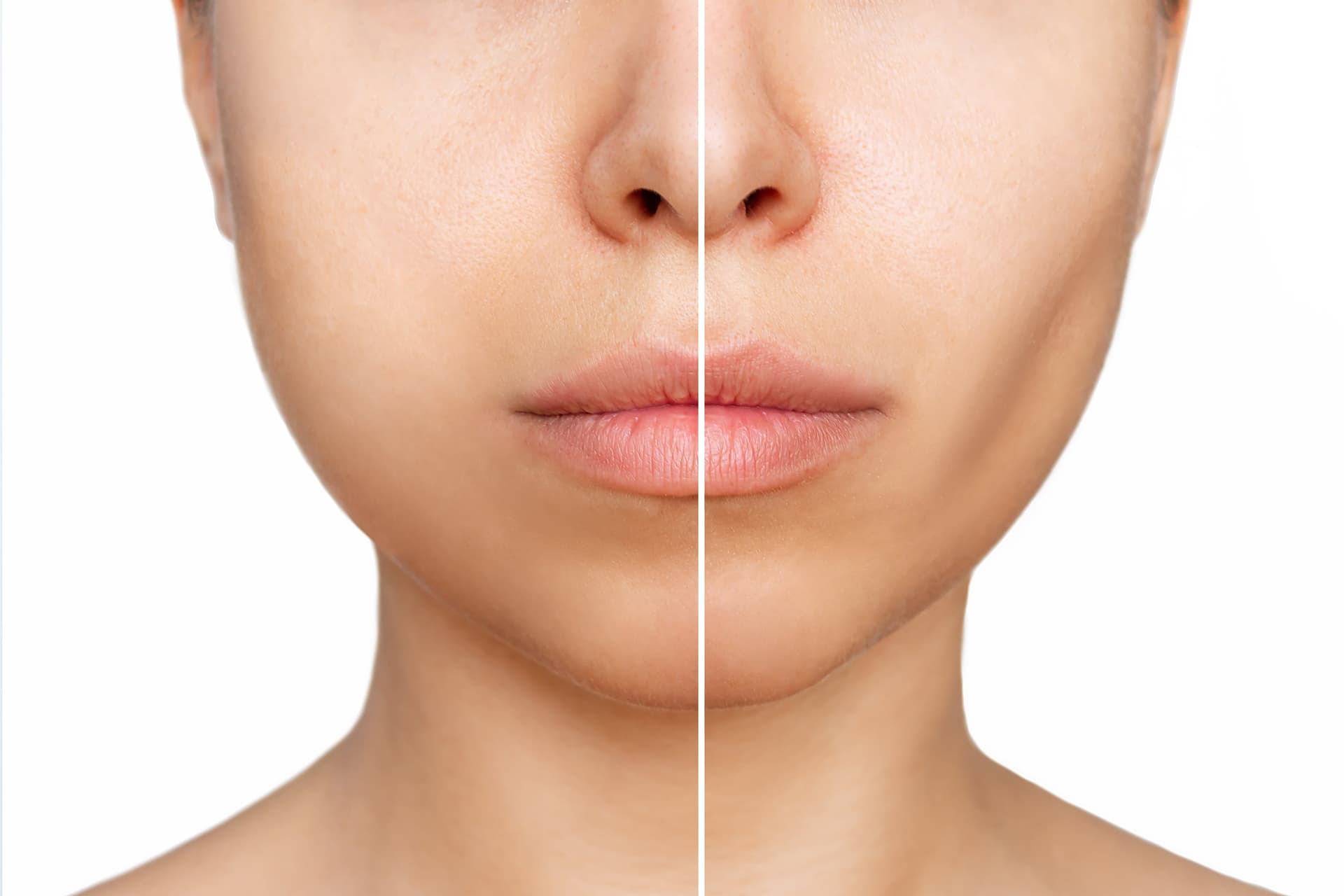 Ozempic Face: How To Avoid Ozempic Facial Ageing